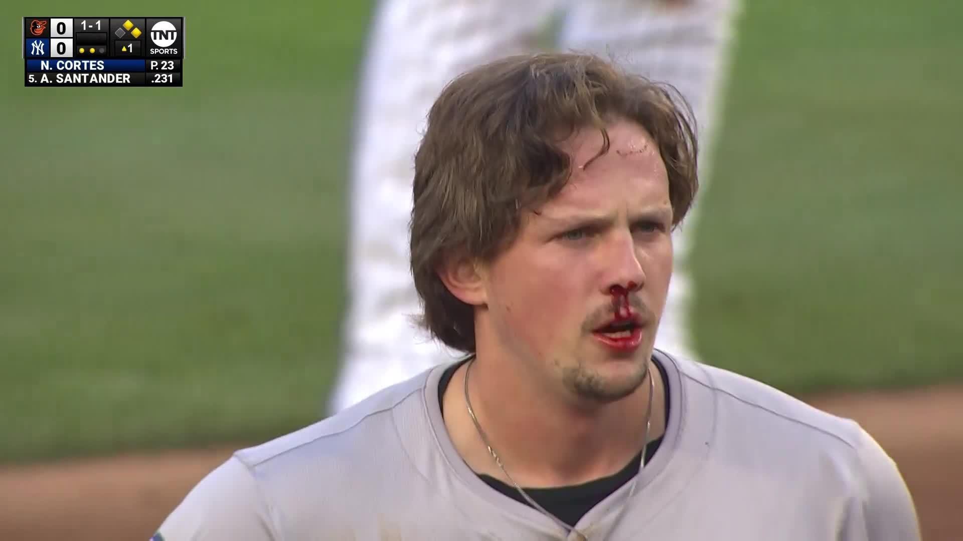 Video: Yankees, Orioles Clear Benches, Scuffle After Kjerstad Hit in Head by Pitch | News ...